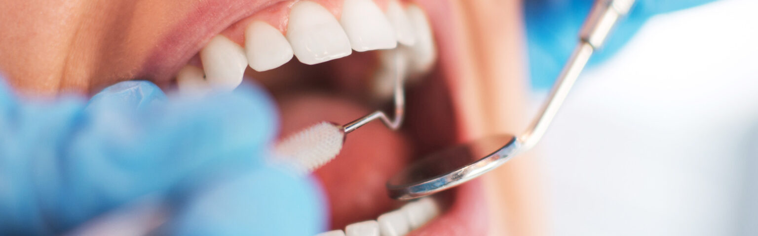 O Registro Periodontal Simplificado - Conexão Odontoprev